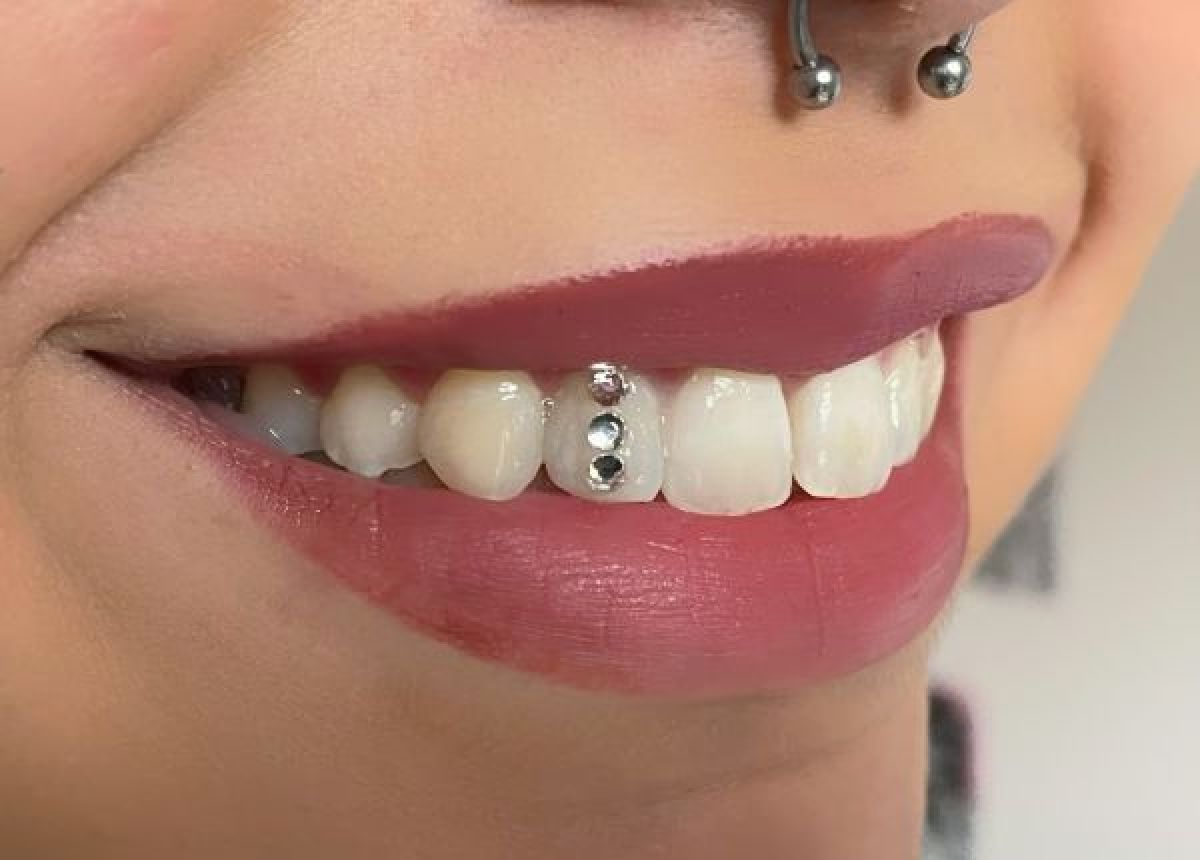 Strass dentaire à Le Havre (76) Par Pauline - Estheca